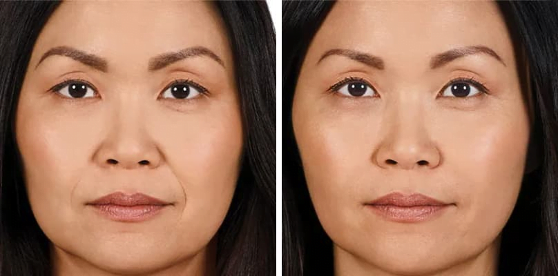 Specials - Boston Plastic Surgery